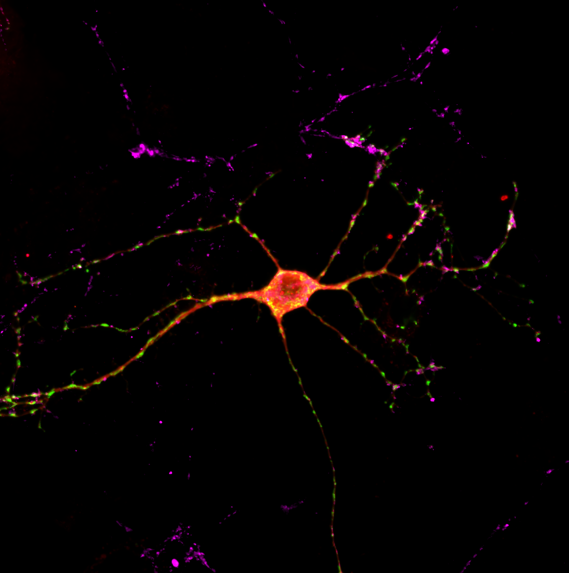 Postdoc position available in the laboratory of Dr. Louis-Eric Trudeau ...